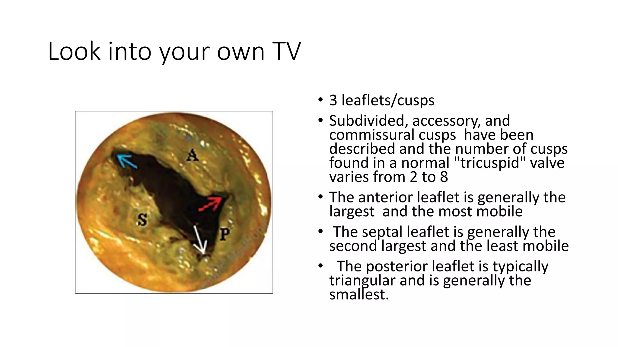 Tricuspid valve | PPTX
