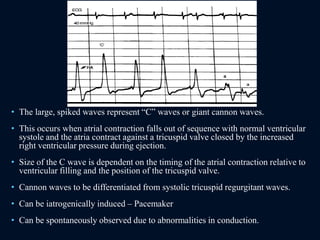 BACK TO BASICS - HEMODYNAMIC ROUNDS - TRICUSPID VALVE | PPTX