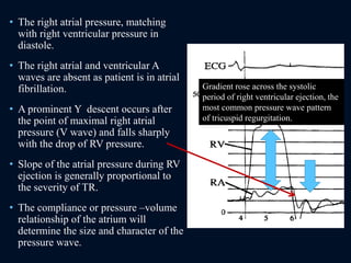 BACK TO BASICS - HEMODYNAMIC ROUNDS - TRICUSPID VALVE | PPTX