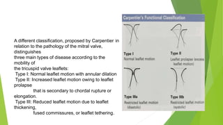 Tricuspid valve disease by T.N. Shanta | PPTX