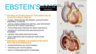 Tricuspid valve disease | PPTX
