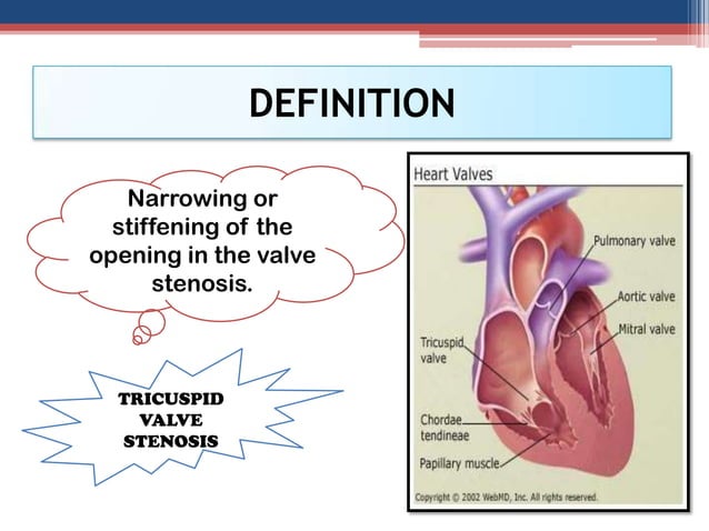 Tricuspid Valve Stenosis Ppt