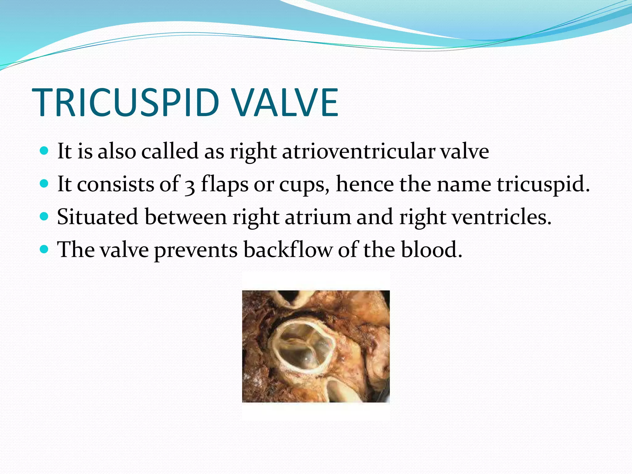 Tricuspid valve stenosis | PPTX