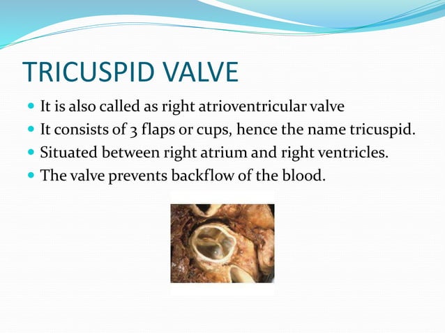 Tricuspid Valve Stenosis Ppt