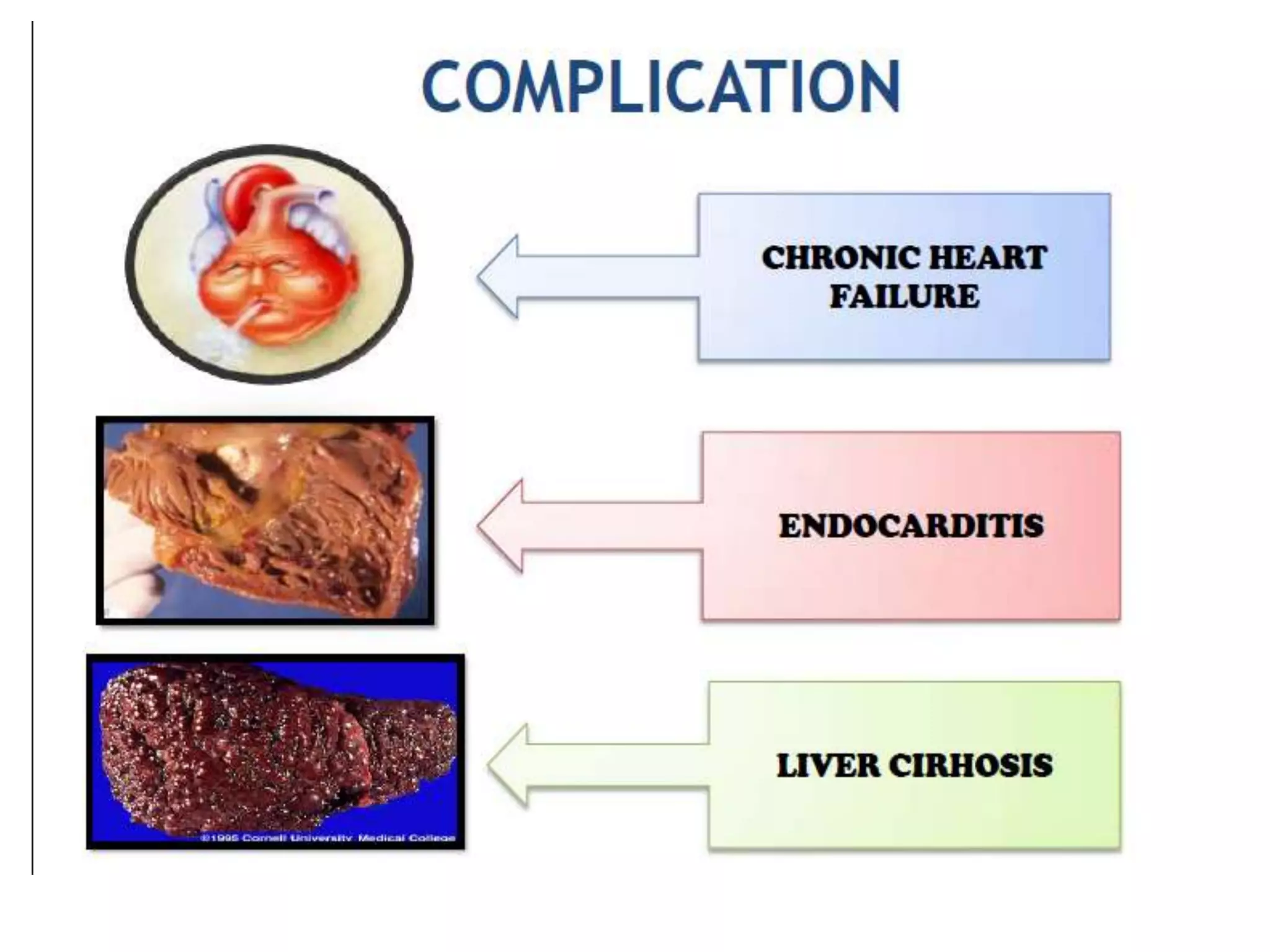 Tricuspid Valvular Heart Disease for post graduates | PPSX