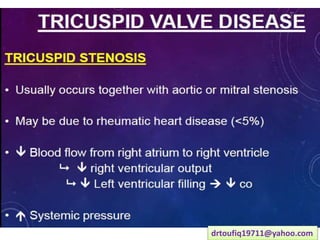 Tricuspid Valvular Heart Disease for post graduates | PPSX
