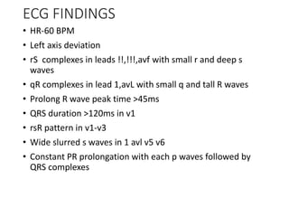 TRIFASCICULAR BLOCK - ECG Presentation.pptx