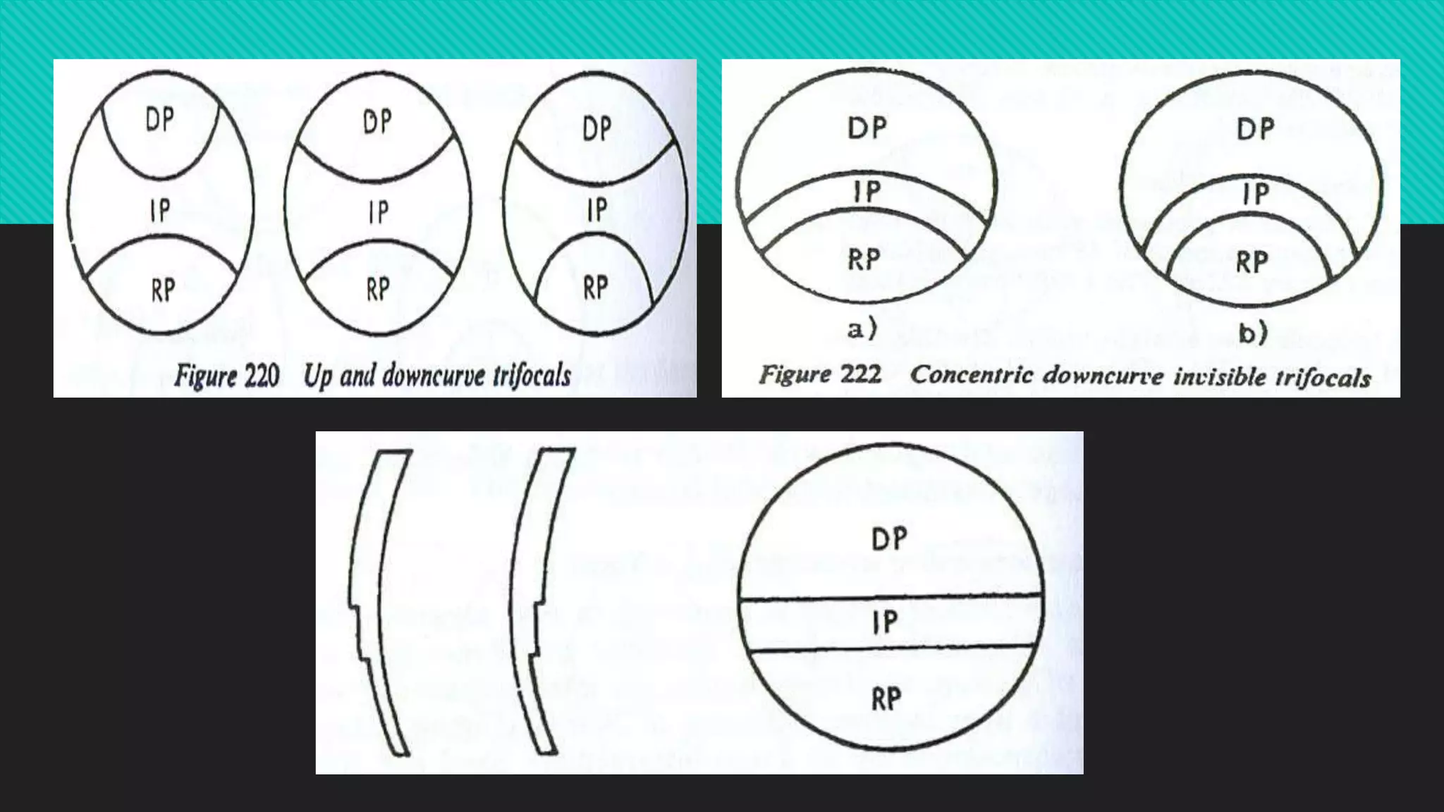 Trifocals | PPTX