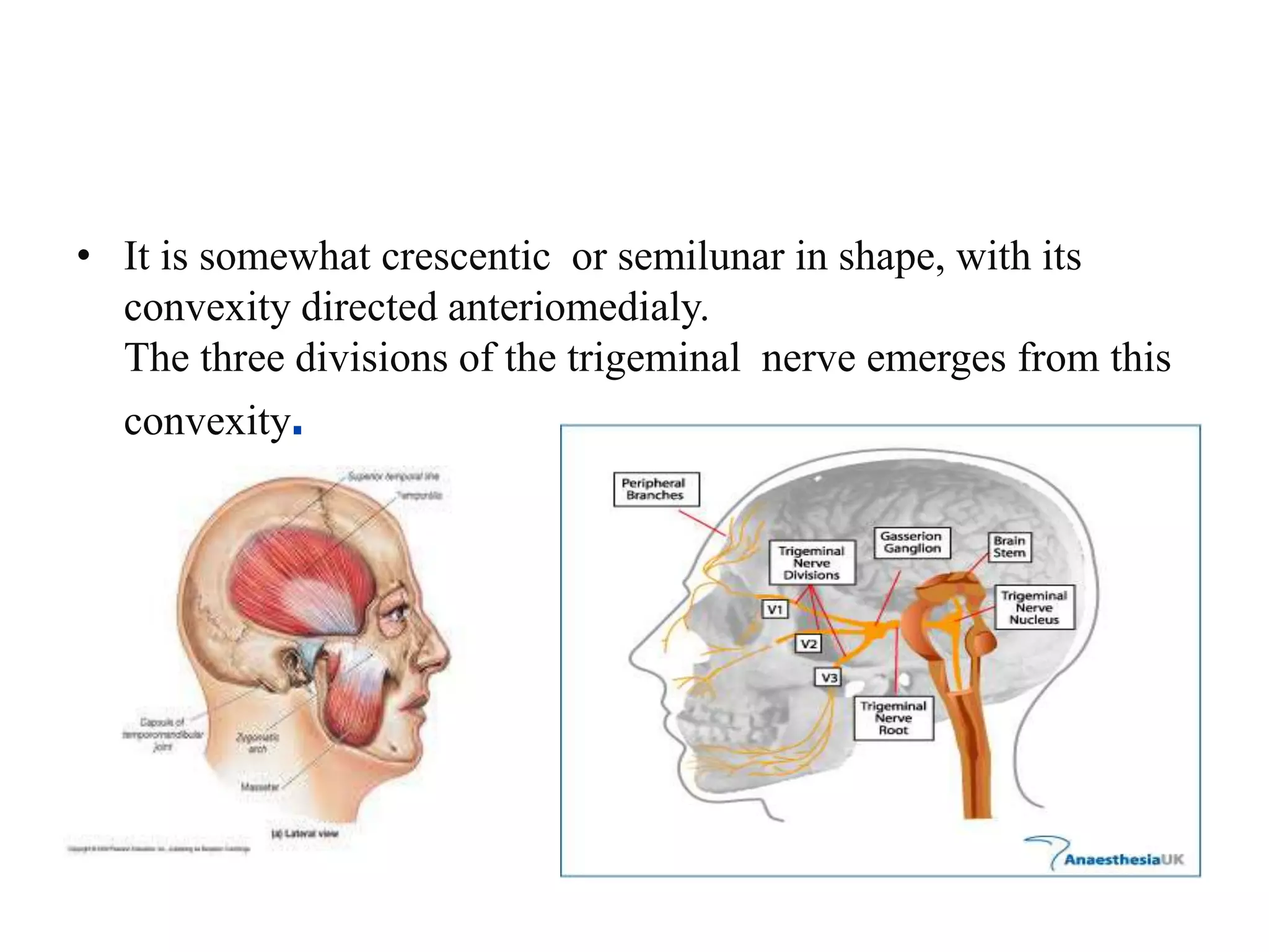 trigeminal-neuralgia (1).pptx