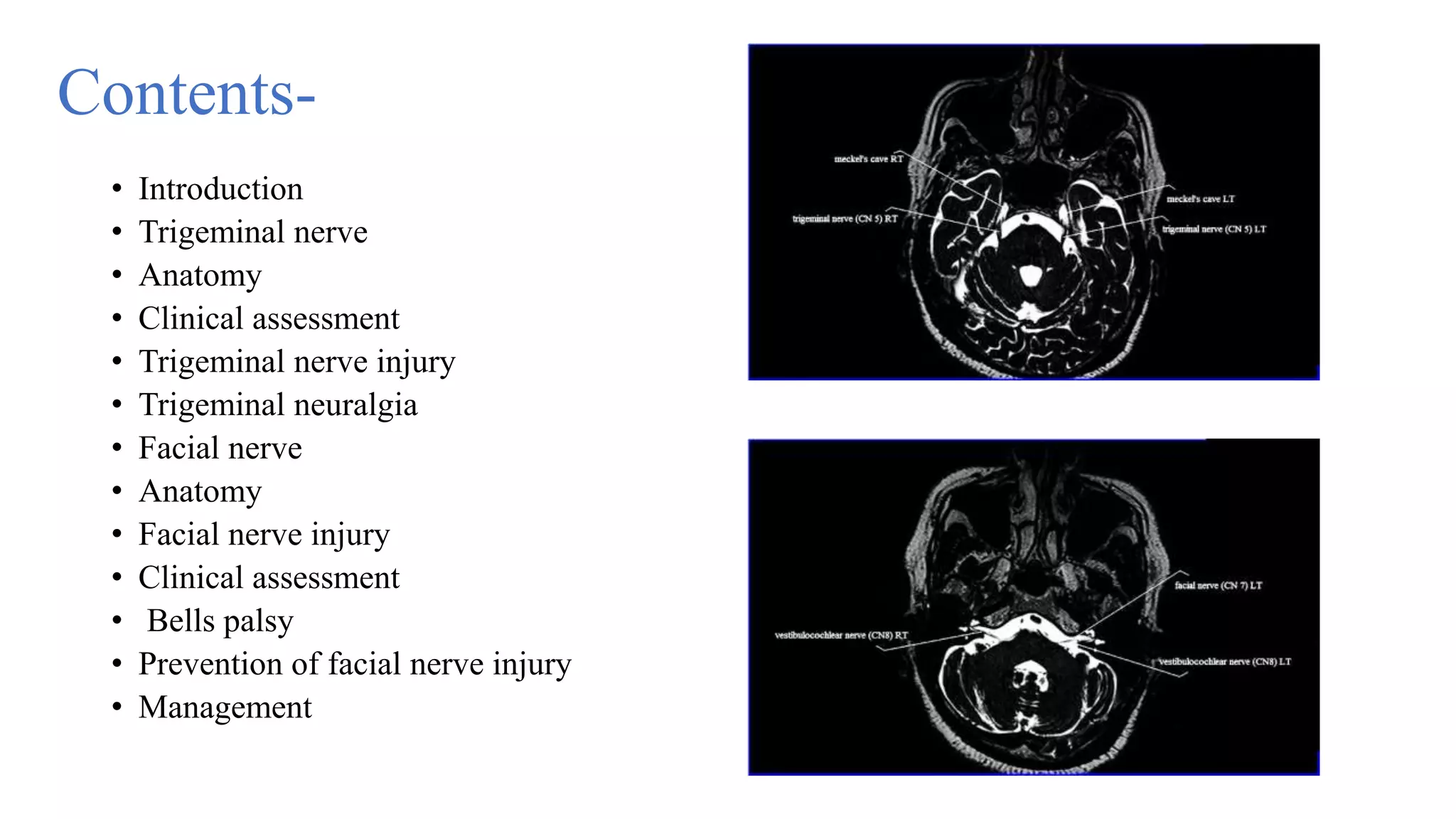Trigeminal and facial nerve.pptx
