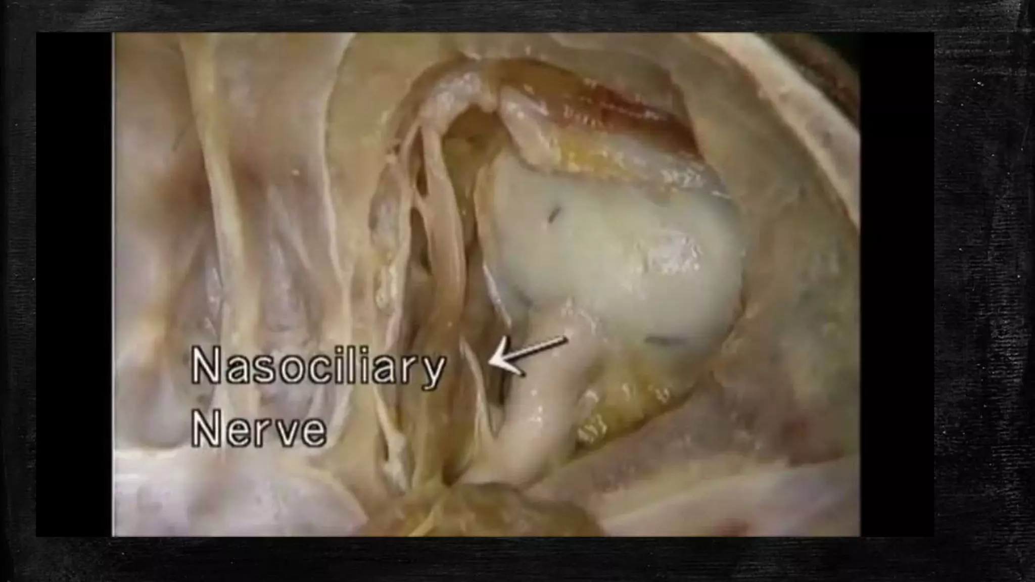 Trigeminal nerve | PPT