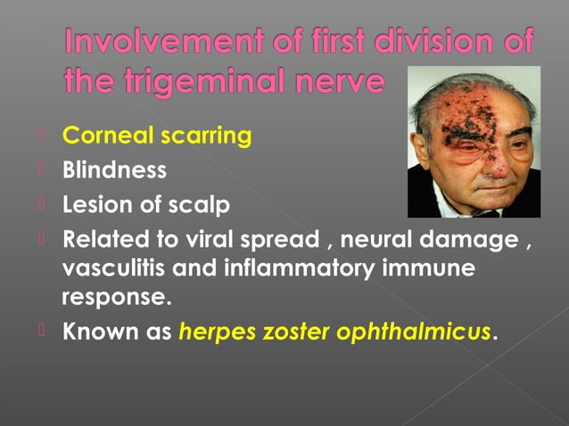 Trigeminal nerve - max and opthalmic div | PPT