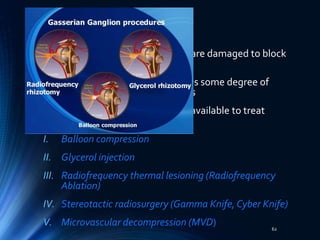 Trigeminal nerve | PPTX