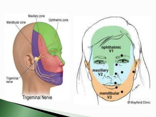 Trigeminal Nerve | PPTX