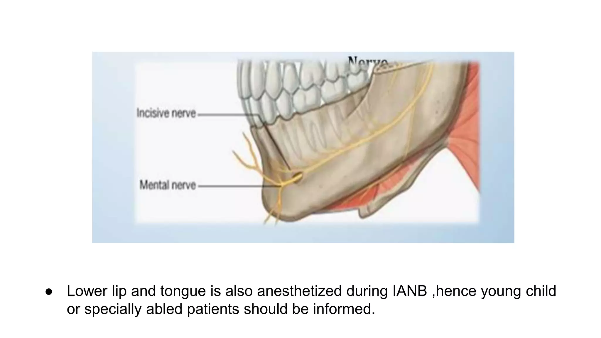 Trigeminal nerve | PPTX