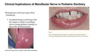 Trigeminal Nerve and Applied Anatomy.ppt