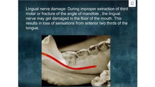 TRIGEMINAL NERVE - FIFTH CRANIAL NERVE.pptx
