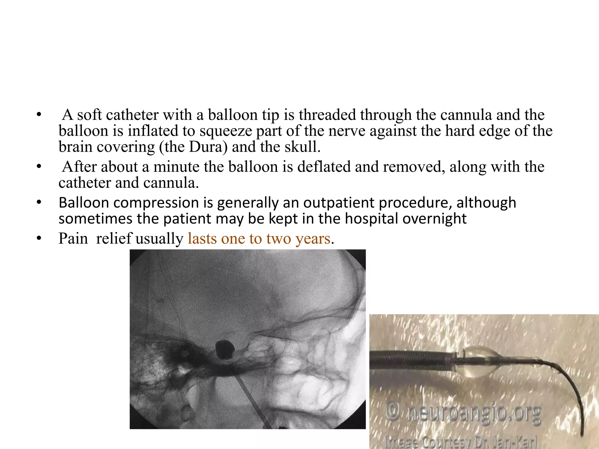 Trigeminal nerve applied anatomy(part 2) | PPT