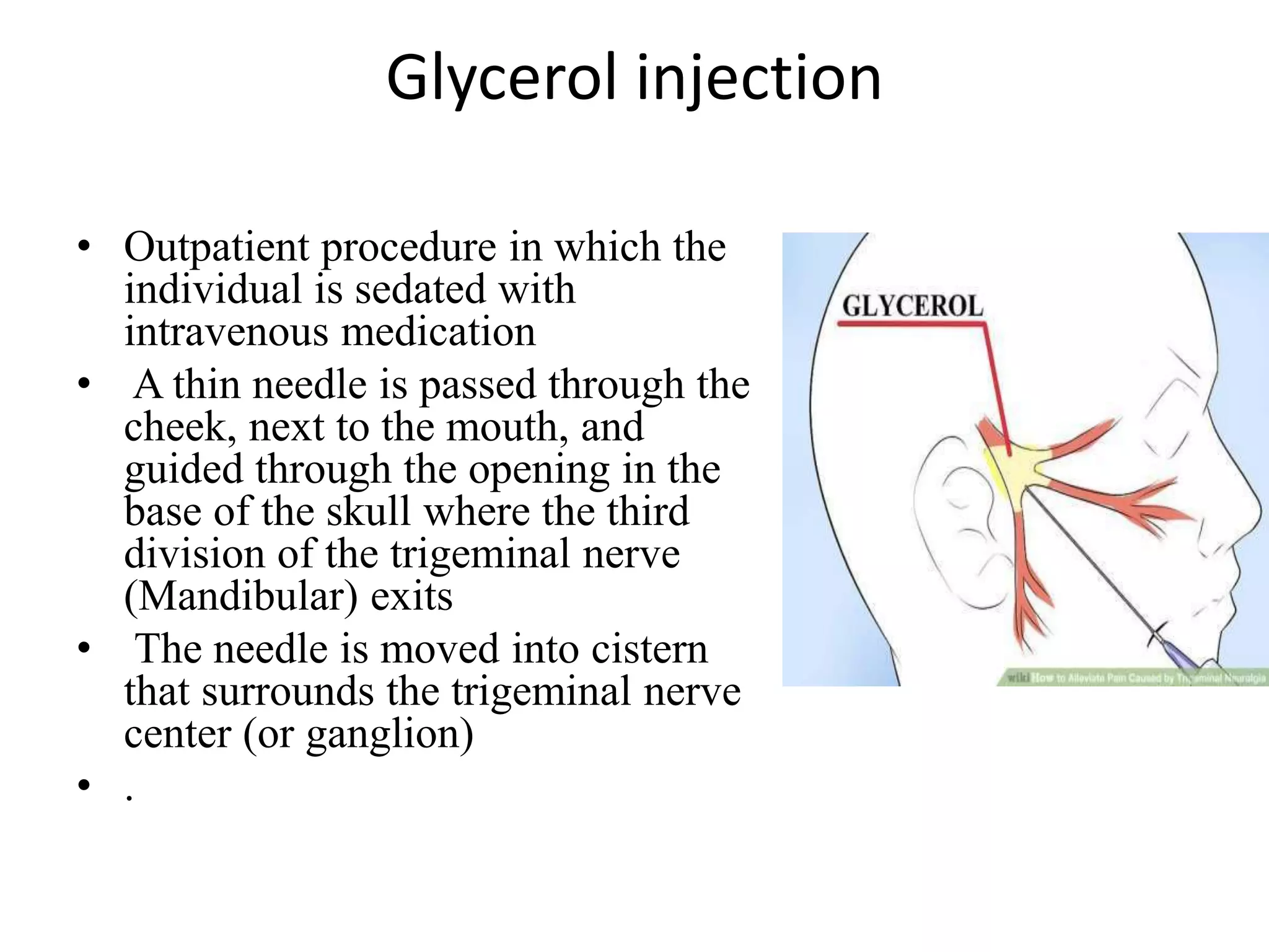 Trigeminal nerve applied anatomy(part 2) | PPTX