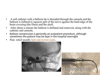 Trigeminal nerve applied anatomy(part 2) | PPT