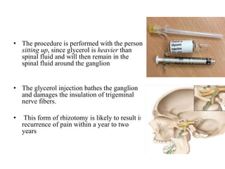 Trigeminal nerve applied anatomy(part 2) | PPT