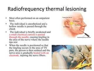 Trigeminal nerve applied anatomy(part 2) | PPT