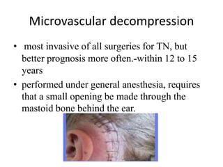 Trigeminal nerve applied anatomy(part 2) | PPT