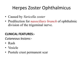 Trigeminal nerve applied anatomy(part 2) | PPT