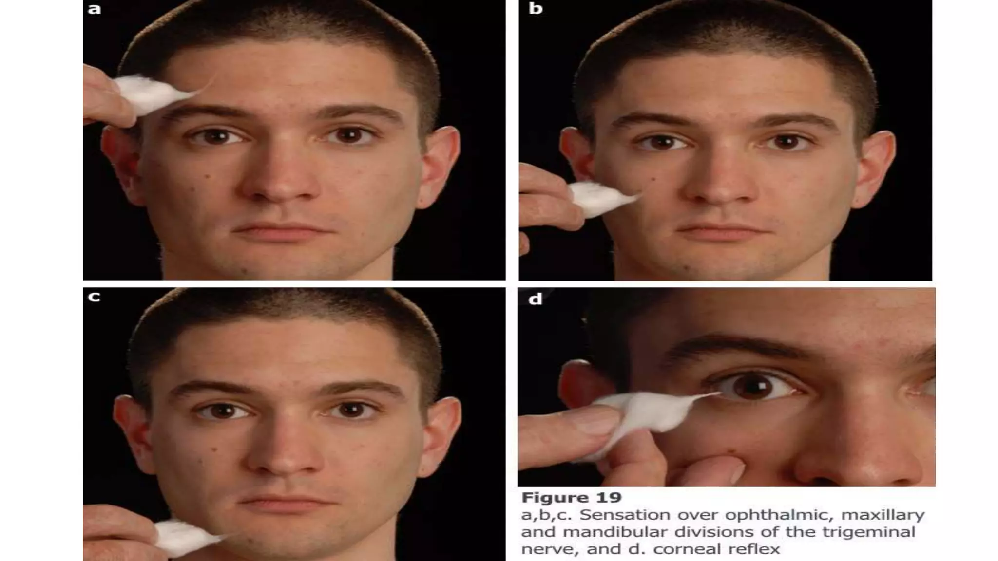 Trigeminal nerve cranial nerve | PPTX