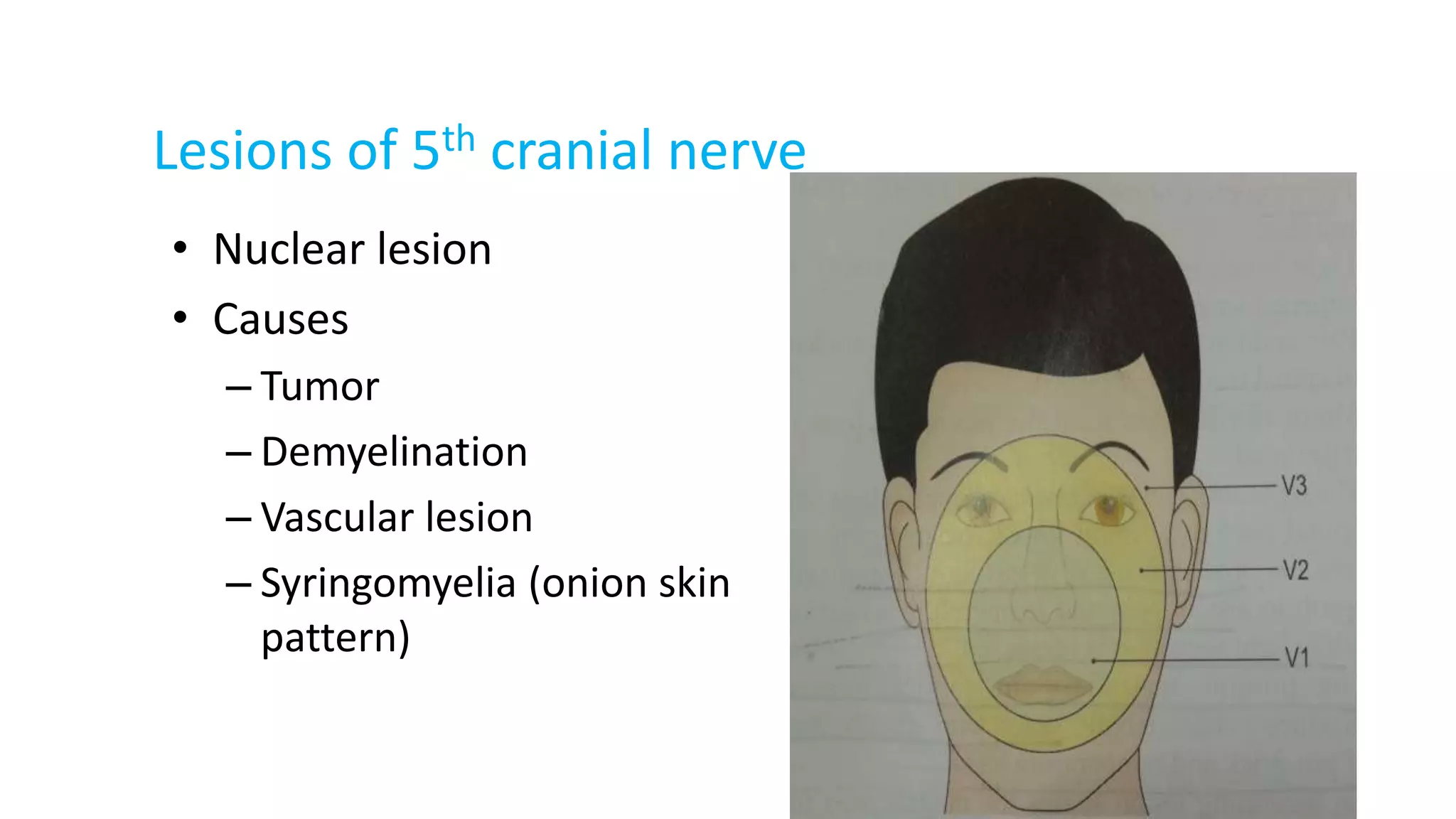 Trigeminal nerve cranial nerve | PPTX