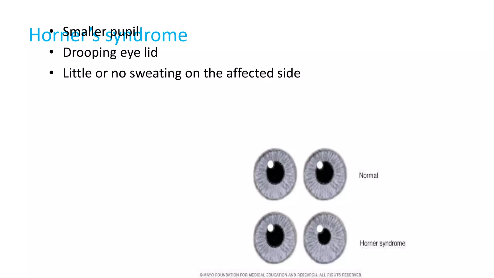 Trigeminal nerve cranial nerve | PPTX