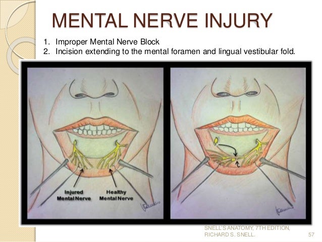 Trigeminal nerve 1