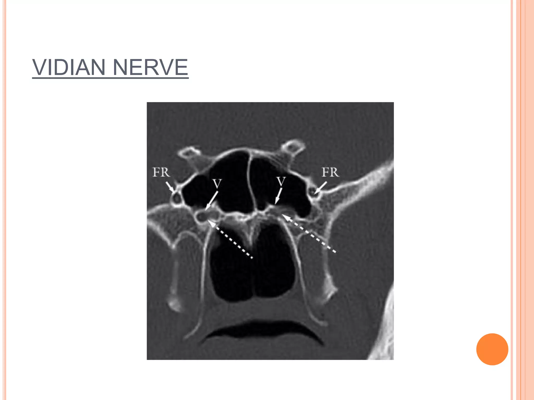 Trigeminal nerve: A clinical overview in ENT | PPTX