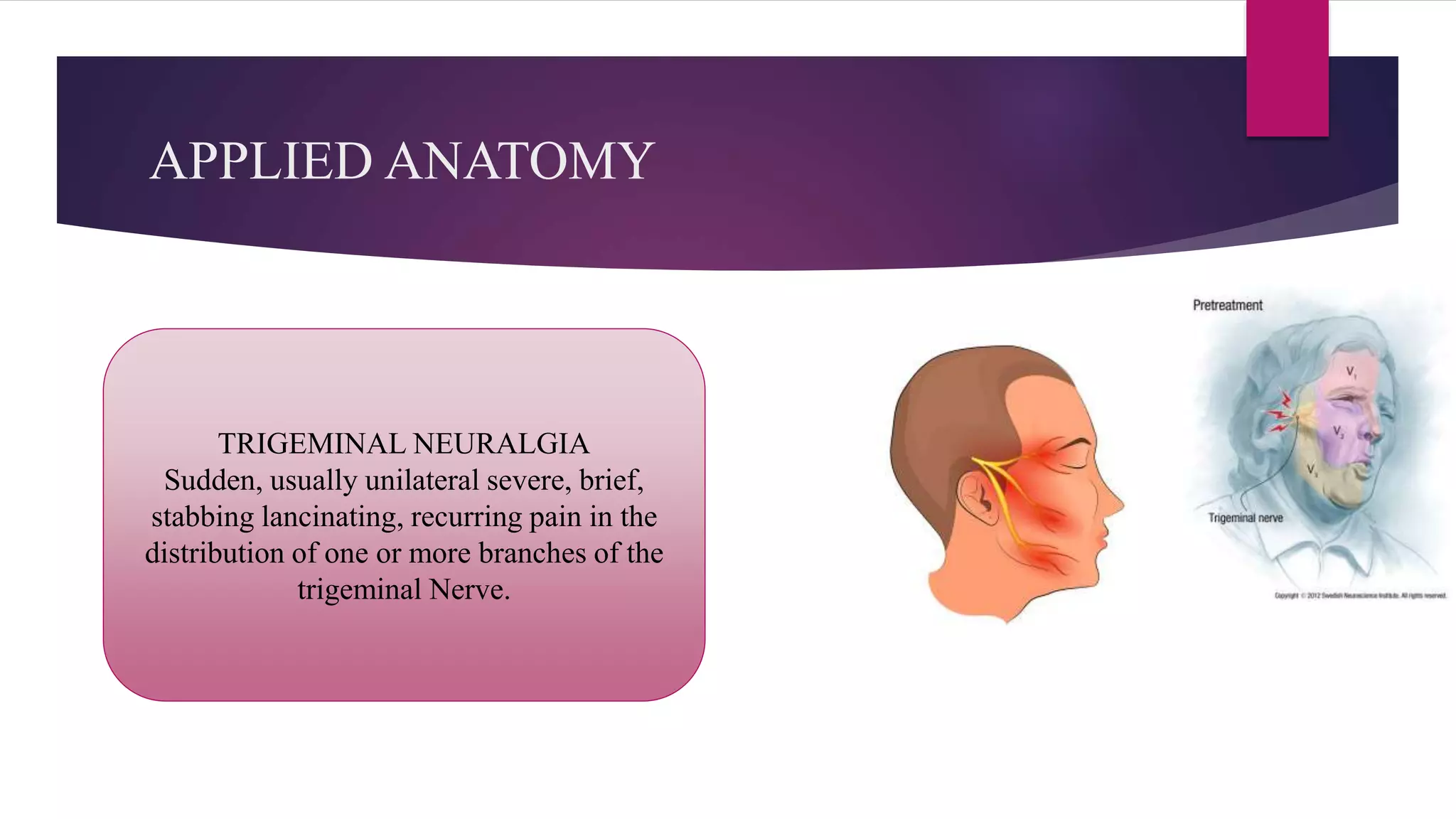 Trigeminal nerve | PPTX