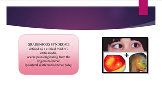 Trigeminal nerve | PPTX