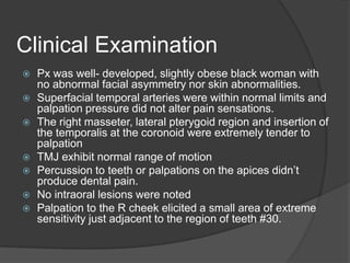 Trigeminal neuralgia | PPTX