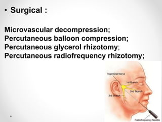 Trigeminal neuralgia | PPTX