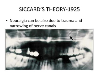 Trigeminal neuralgia | PPTX