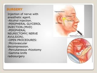 Trigeminal neuralgia | PPTX