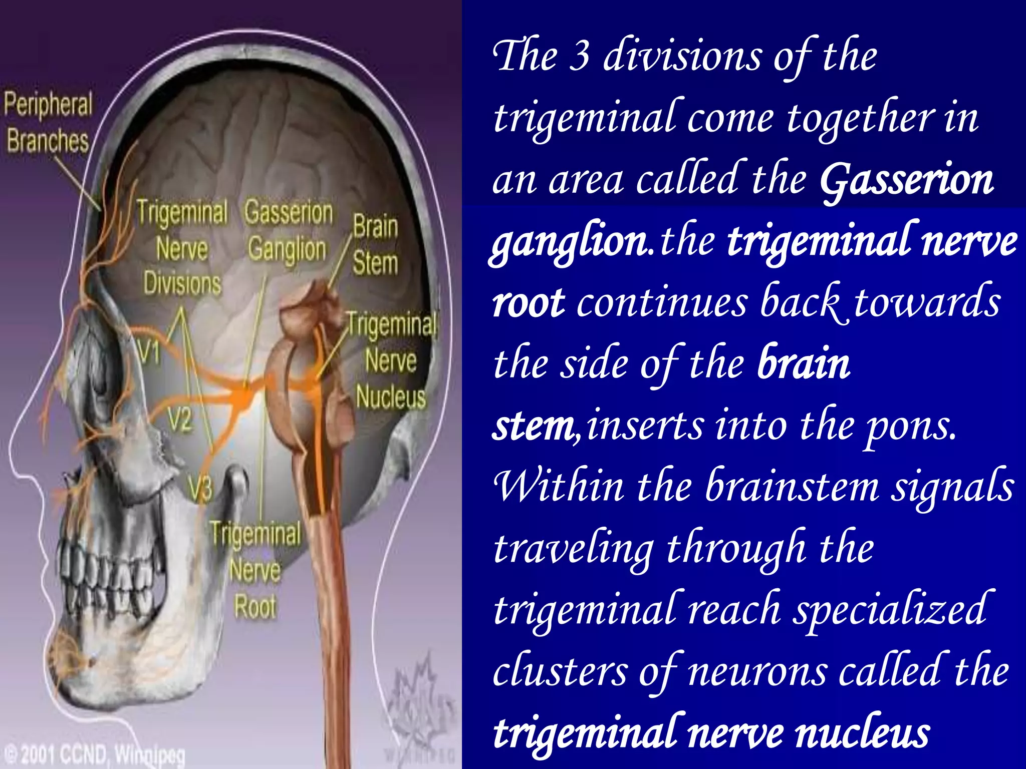 Trigeminal Neuralgia | PPT
