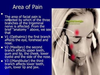 Trigeminal Neuralgia | PPT