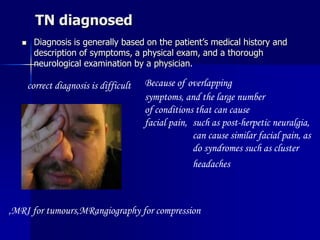 Trigeminal Neuralgia | PPT