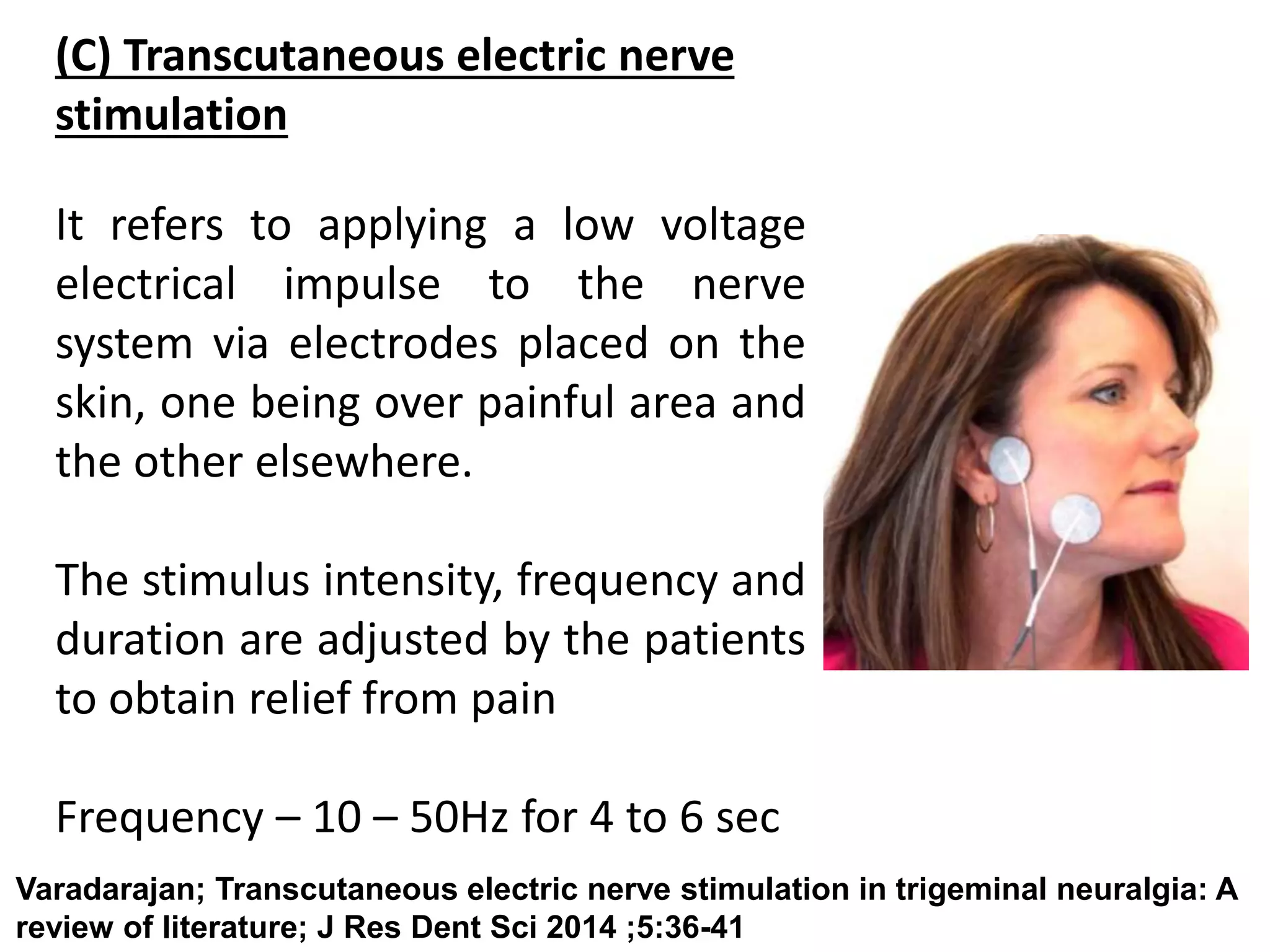 Trigeminal neuralgia in OMFS | PPT