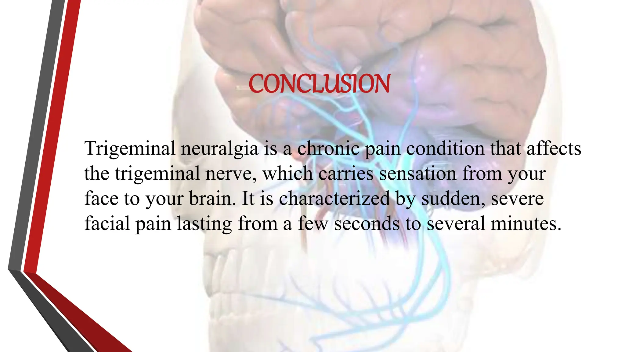 trigeminal neuralgia.pptx