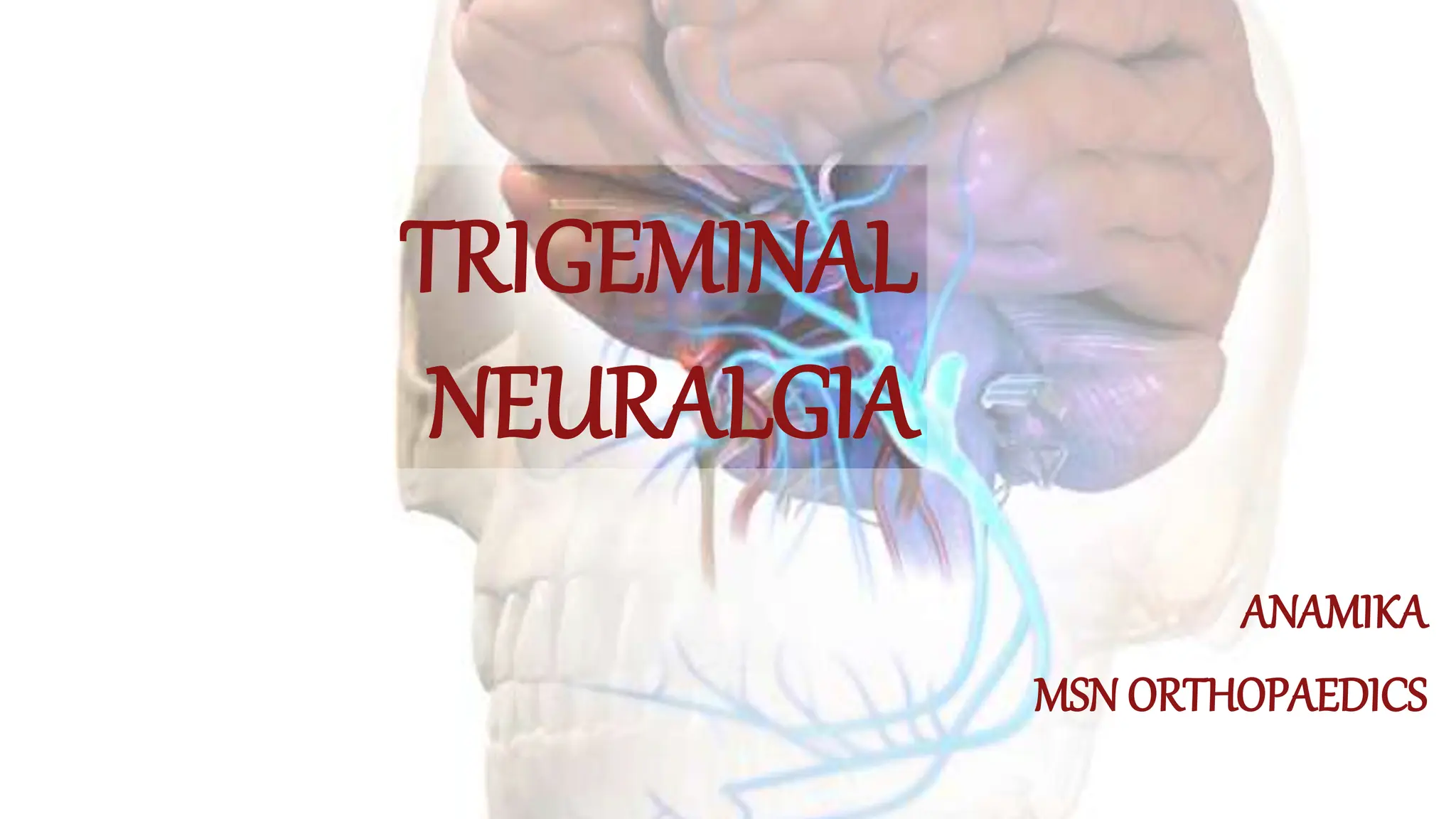 trigeminal neuralgia.pptx