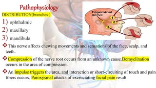 trigeminal neuralgia.pptx