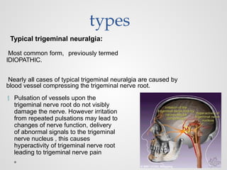 trigeminal neuralgia and nursing management .pptx
