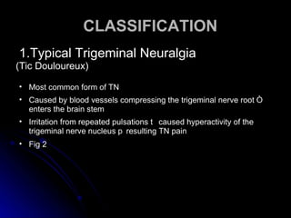Trigeminal neuralgia 2_ | PPT