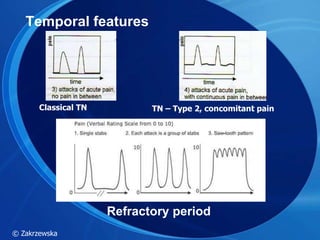 Trigeminal neuralgia, facial pain in MS | PDF