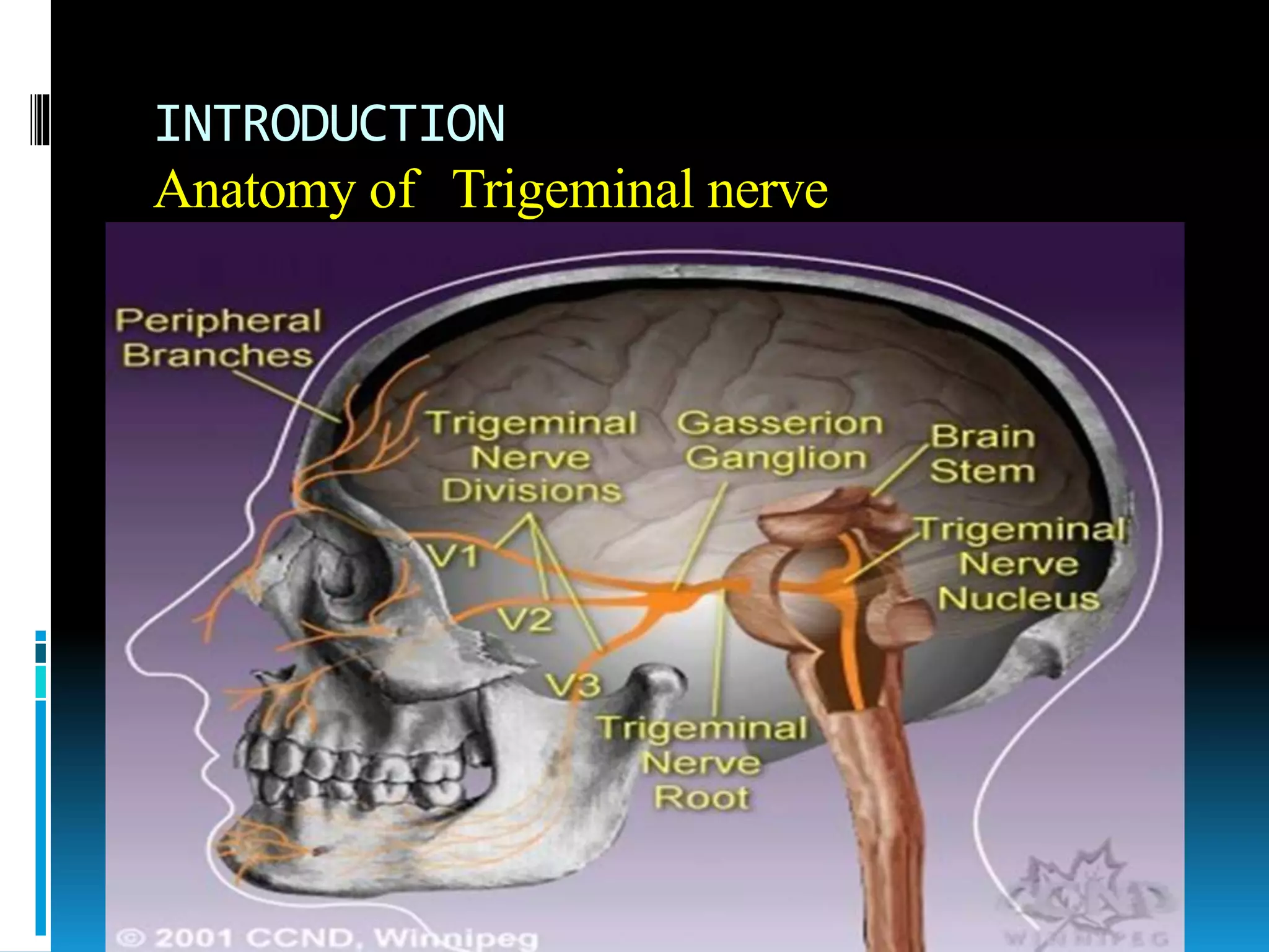 Trigeminalneuralgiaseminar2 180526065218-converted | PPTX